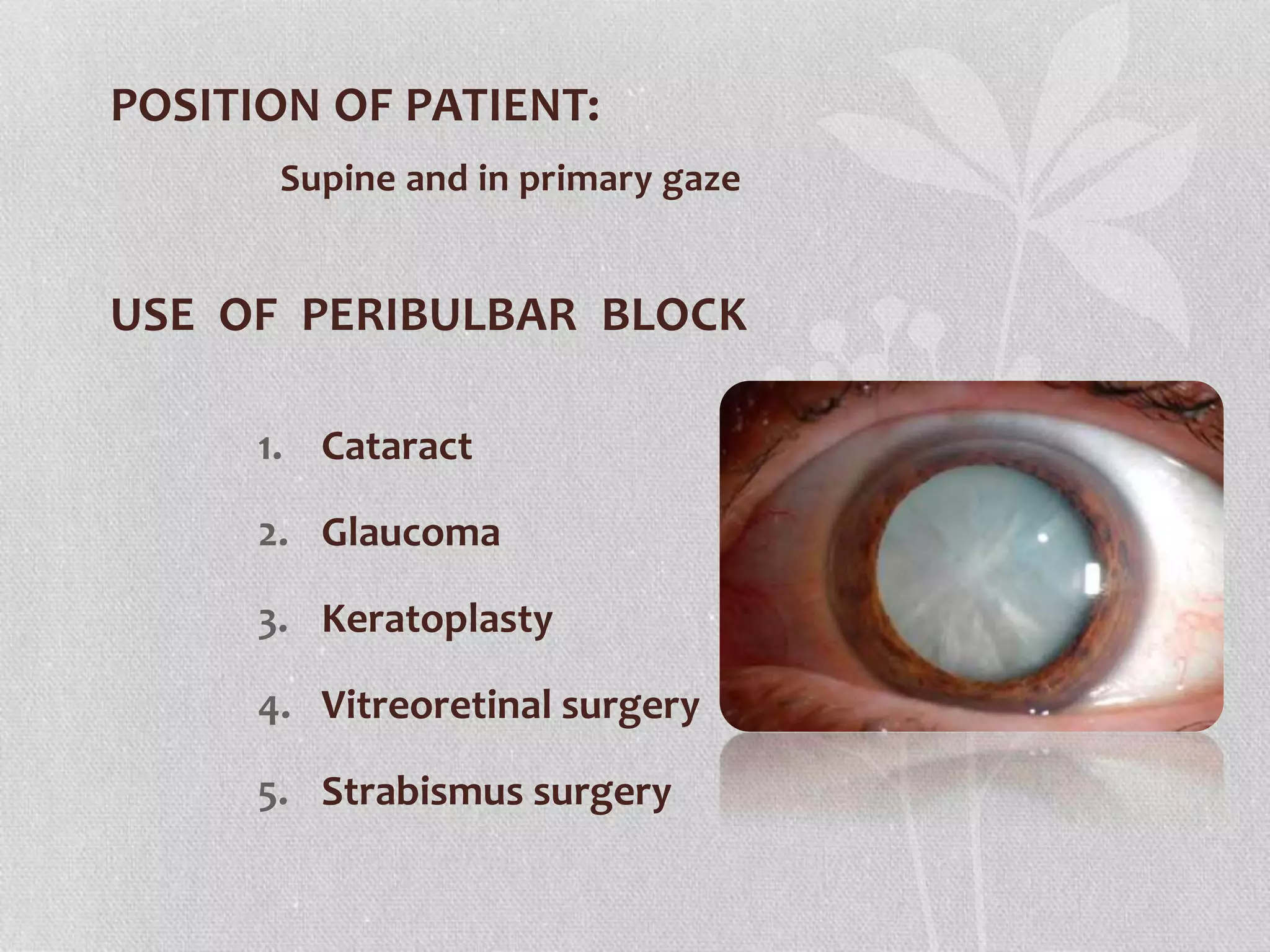 Ocular anaesthesia | PPTX