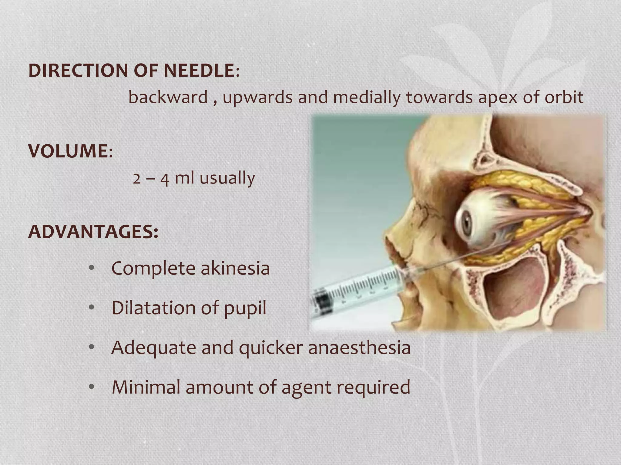 Ocular anaesthesia | PPTX
