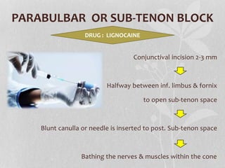 Ocular anaesthesia | PPTX