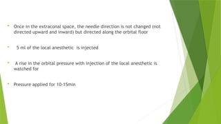 Presentation onOCULAR ANAESTHESIA in ophthalmology | PPTX