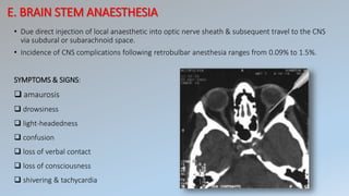 Ocular anaesthesia by dr.roopashree.c .r | PPTX