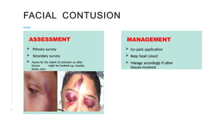 Ocular and faciomaxillary trauma - reviewed.ppt