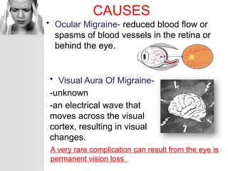 Spotlight On Ocular Migraine & Visual Migraine | PPTX