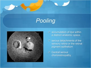 Ocular angiography | PPT