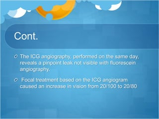 Ocular angiography | PPT