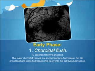 Ocular angiography | PPTX