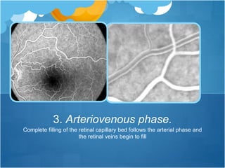 Ocular angiography | PPTX
