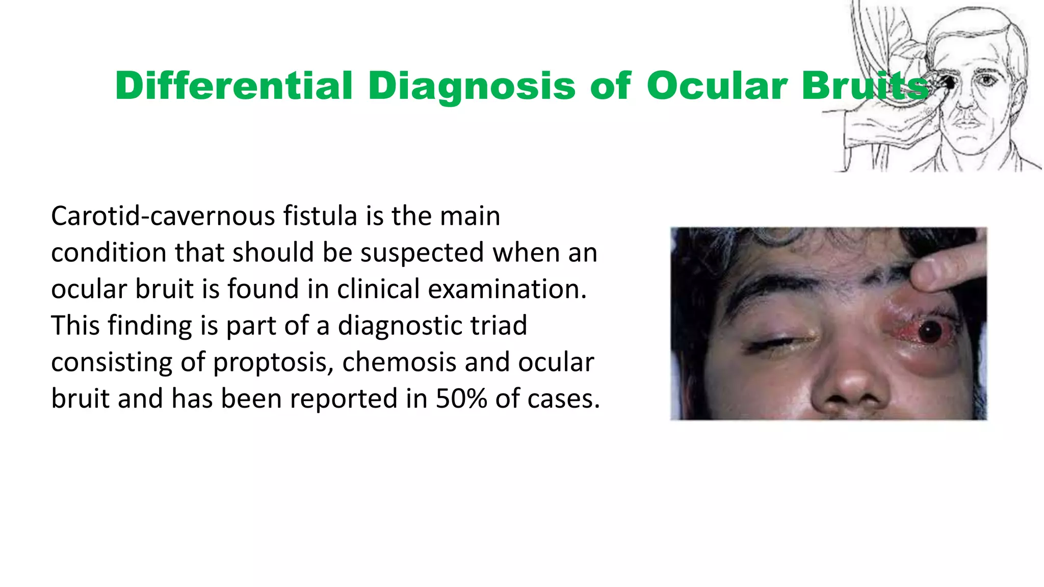 Ocular/ orbital auscultation-Technique | Ocular Bruits| Conditions ...