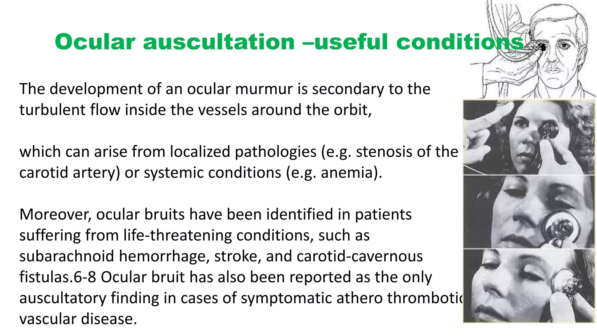 Ocular/ orbital auscultation-Technique | Ocular Bruits| Conditions ...