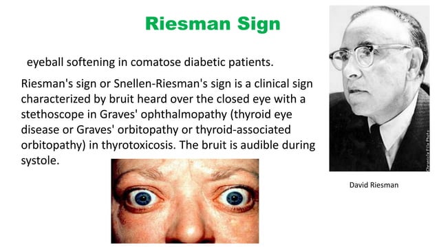 Ocular/ orbital auscultation-Technique | Ocular Bruits| Conditions ...