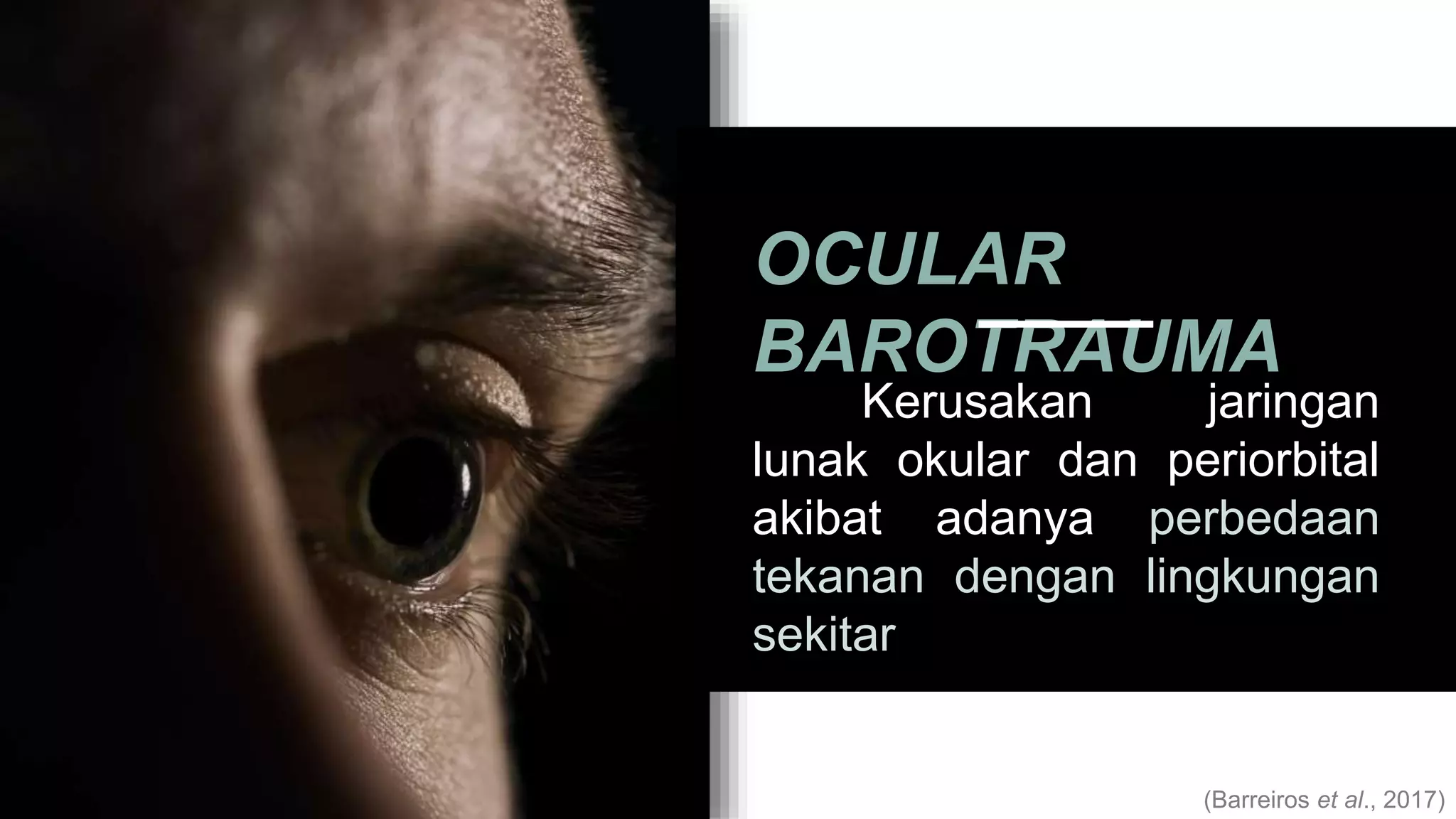 Ocular barotrauma 1.pptx