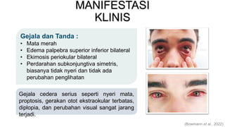 Ocular barotrauma 1.pptx