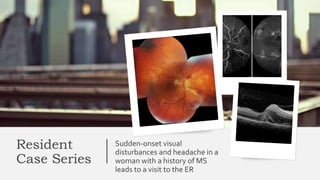 Behçet’s disease | PPT