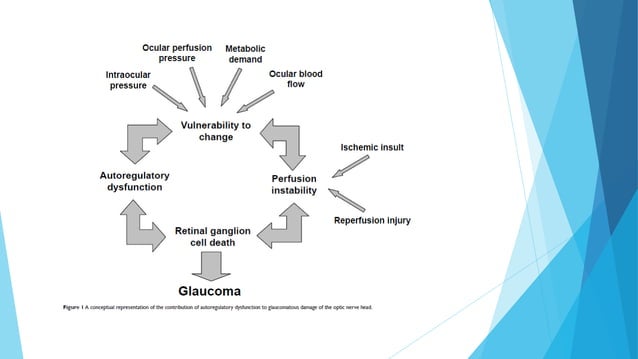 Ocular blood flow in glaucoma | PPTX | Eye and Vision Conditions ...