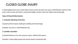 OCULAR BLUNT TRAUMA-1 .pptx
