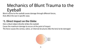 OCULAR BLUNT TRAUMA-1 .pptx