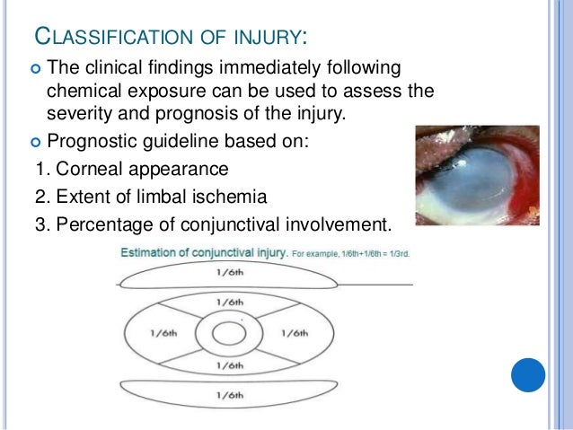Ocular chemical injury
