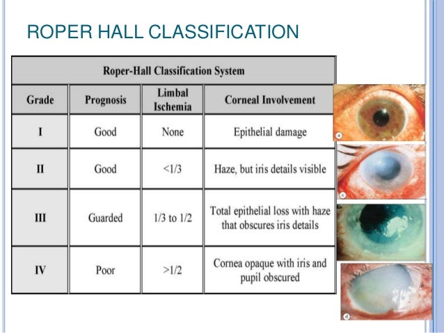 Ocular chemical injury