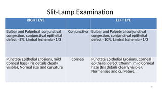 Ocular Chemical Injury Case Presentation - Dr. Prabhat Devkota | PPTX