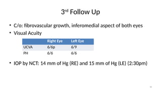 Ocular Chemical Injury Case Presentation - Dr. Prabhat Devkota | PPTX