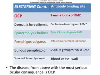 Ocular cicatricial pemphigoid [1] 4th year pco rotation | PPTX