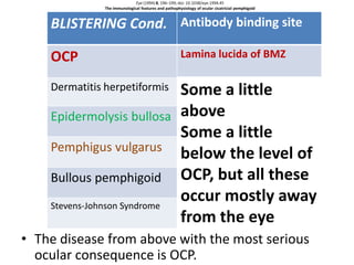 Ocular cicatricial pemphigoid [1] 4th year pco rotation | PPTX