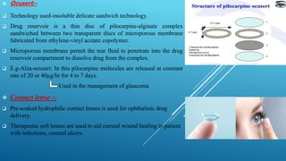 Ocular controlled drug delivery system | PPTX | Eye and Vision ...