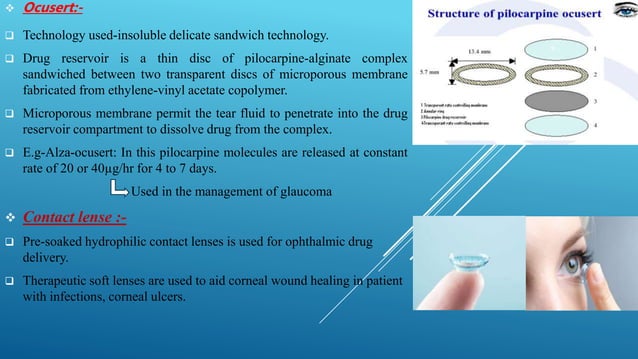 Ocular controlled drug delivery system | PPTX | Eye and Vision ...
