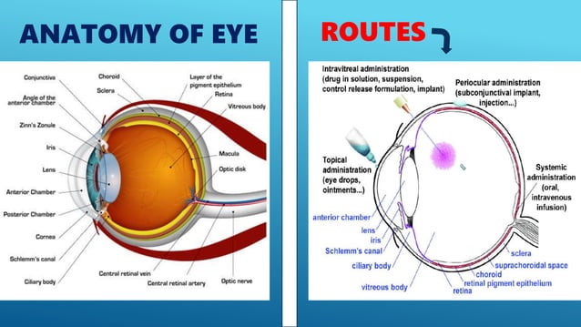 Ocular controlled drug delivery system | PPTX | Eye and Vision ...