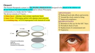 Ocular drug delivery system (novel drug delivery system).pptx