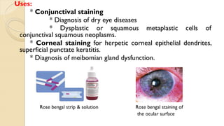 Ocular diagnostic dyes.pdf
