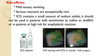 Ocular diagnostic dyes.pdf