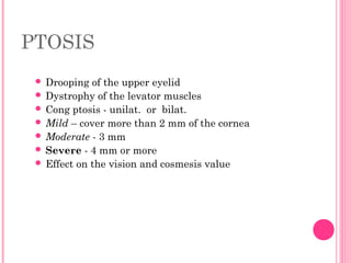 Ocular disease in peadiatric | PPT