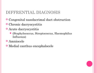 Ocular disease in peadiatric | PPT