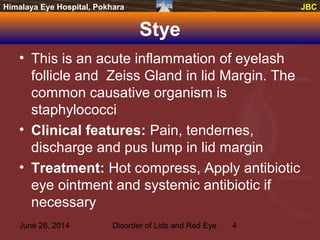 Ocular disorder | PPT