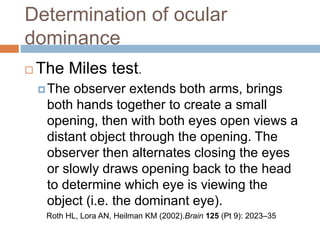 Ocular Dominance | PPTX