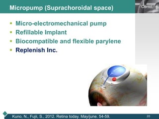 Ocular drug delivery ppt | PPT