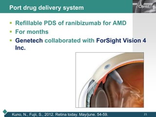 Ocular drug delivery ppt | PPTX