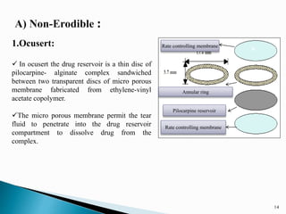 Ocular drug delivery system | PPT