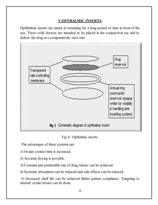 Ocular drug delivery system | DOCX | Eye and Vision Conditions ...