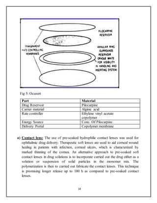 Ocular drug delivery system | DOCX | Eye and Vision Conditions ...