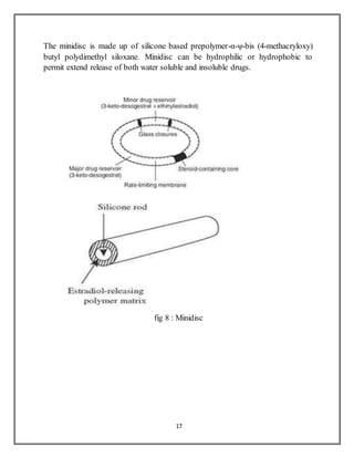 Ocular drug delivery system | DOCX | Eye and Vision Conditions ...