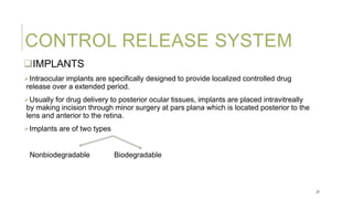 Ocular drug delivery system | PPTX