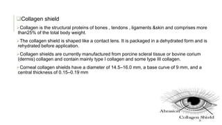Ocular drug delivery system | PPTX