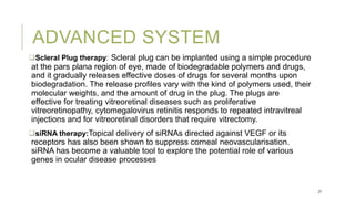 Ocular drug delivery system | PPTX