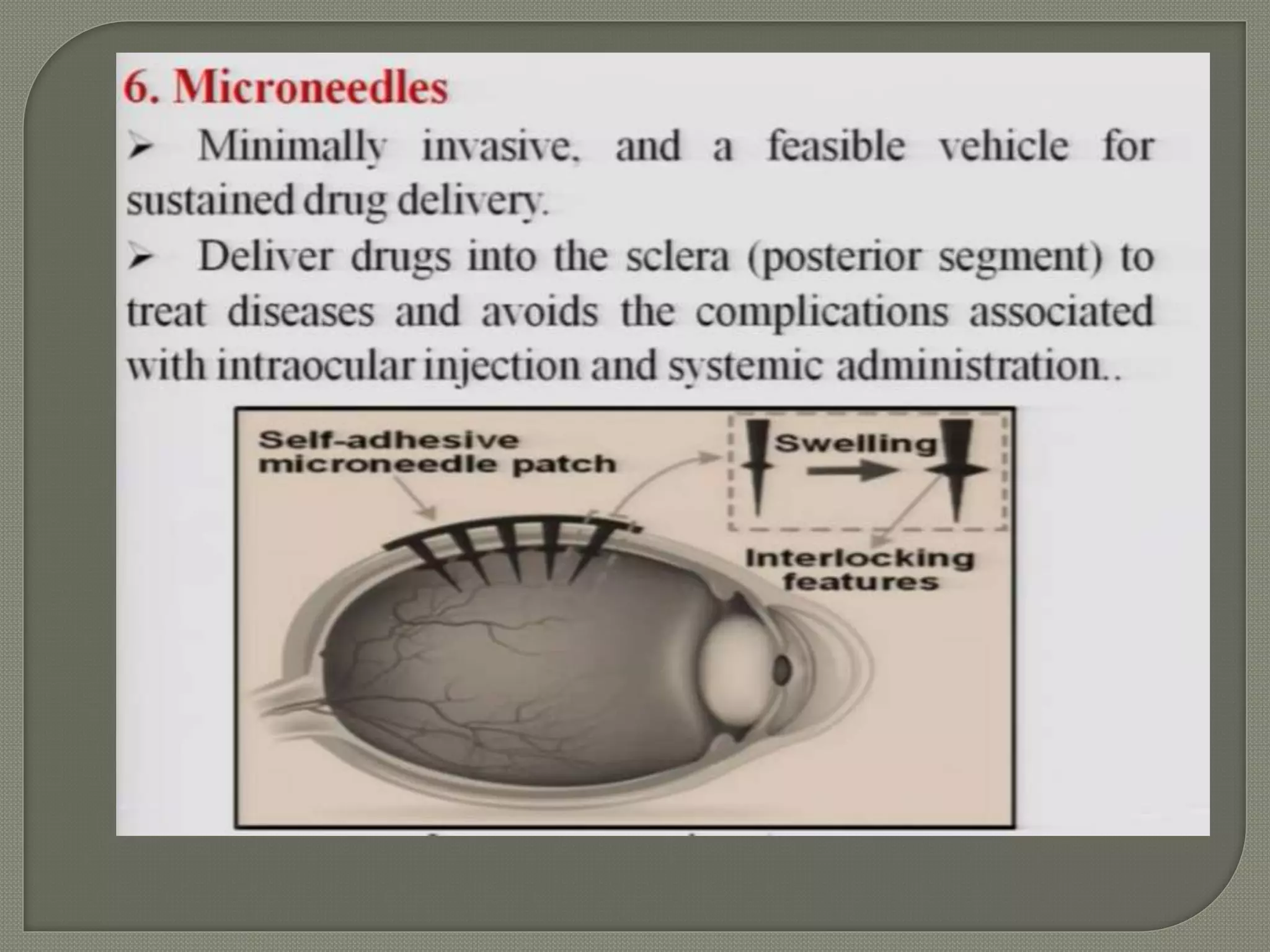 OCULAR DRUG DELIVERY SYSTEM.pptx