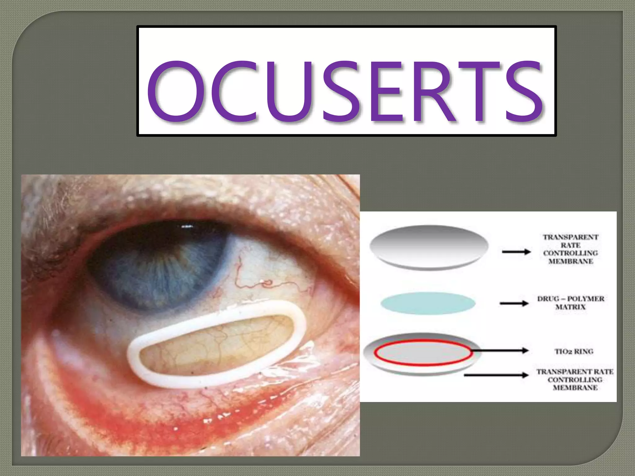 OCULAR DRUG DELIVERY SYSTEM.pptx