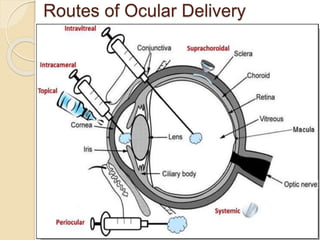 Ocular Drug Delivery System.pptx