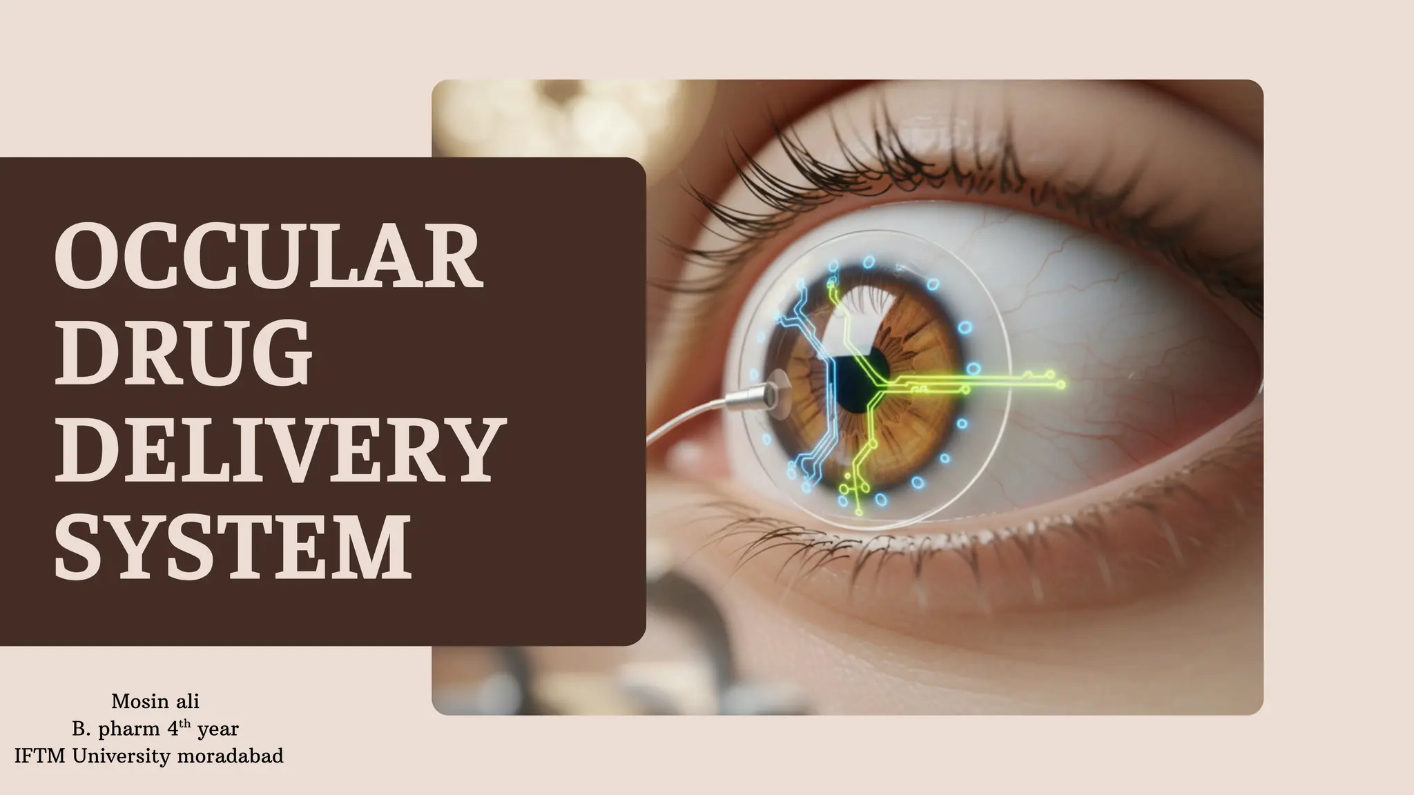 Ocular drug delivery system (novel drug delivery system).pdf