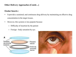 Ocular drug delivery system ppt | PPTX